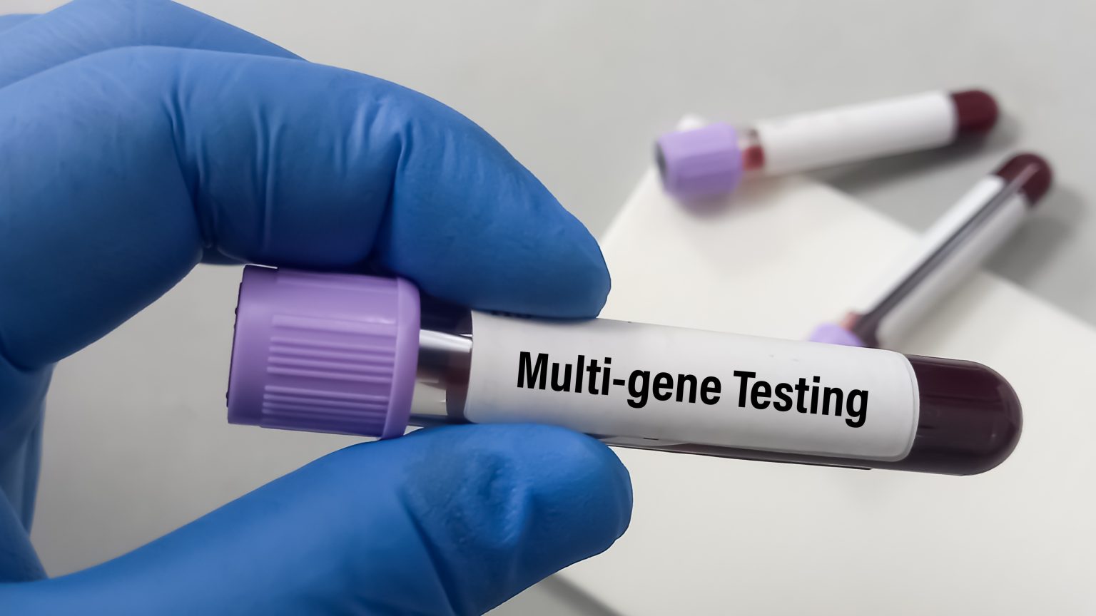 Understanding MTHFR Gene Mutation